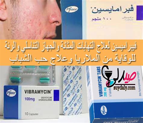 فيبراميسين 100 كبسولات Vibramycin مضاد حيوي لعلاج الأمراض البكتيرية وحب الشباب والتهابات الرئة
