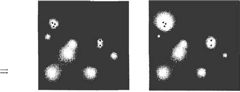 Corrected Normalized Left And Non­ Corrected Normalized Right Level
