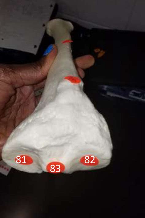 Tibia From The Bottom Diagram Quizlet