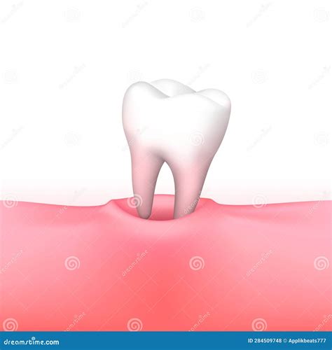 Tooth Loss And Decay Vector Illustration 114875072