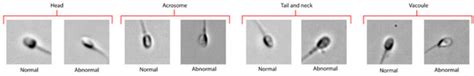 Sperm Abnormality Detection Using Sequential Deep Neural Network