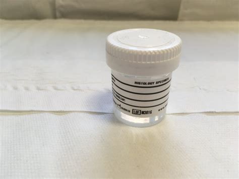 Formalin Filled Specimen Containers Cellular Pathology Exeter Clinical Laboratory International