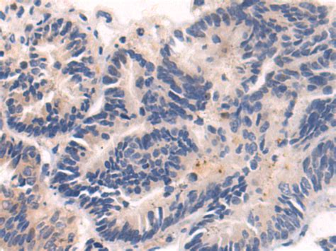 兔抗gal多克隆抗体anti Gal Rabbit Polyclonal Antibody 生命科学产品与技术服务 生工生物工程上海股份有限公司