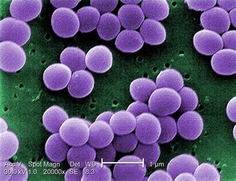 What Type Of Infection Is Caused By Staphylococcus Aureus Researchgate