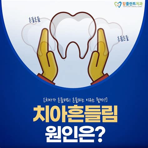 익산탑플란트치과 🦷 치아 흔들림 원인은 무엇일까요 ⠀⠀ 1 잇몸의문제 2 충치 3 교정 4