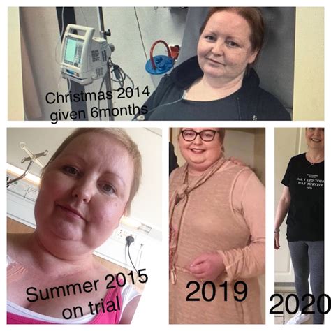 Sonya World Pancreatic Cancer Coalition