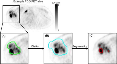 Process Of Template Roi Generation For Segmentation Implementation