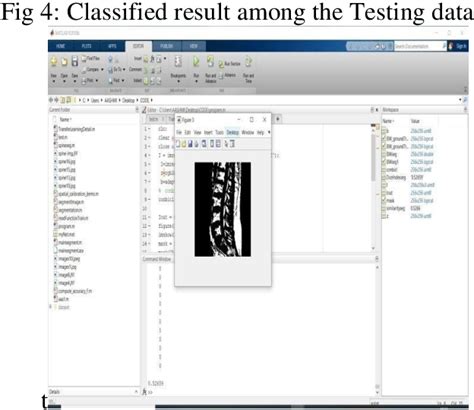 Figure 4 From Classification Of Defected Spine And Segmentation Using Deep Learning Semantic
