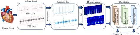 Figure 1 From Cardiovascular Diseases Classification Using High Resolution Superlet Transform