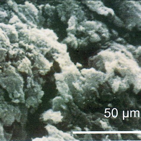Sem Micrograph Showing Bone Matrix With Crystalline Structures [the Download Scientific Diagram