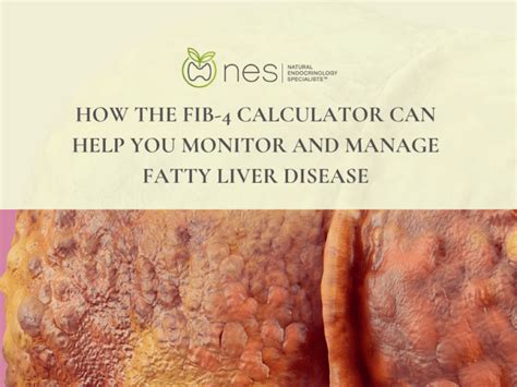 How The Fib 4 Calculator Can Help You Monitor And Manage Fatty Liver Disease Natural