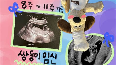 호주 • Vlog 엄마가 되었어요 👶🏻👶🏻 쌍둥이임신 8주에서 11주 Youtube