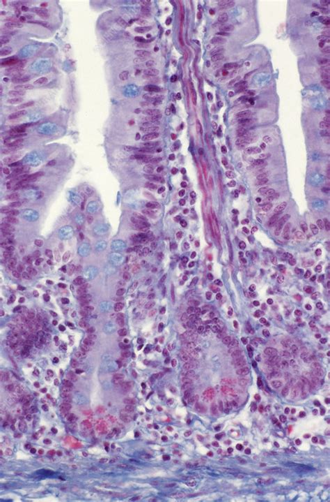 Small Intestine Lining Stock Image P5200146 Science Photo Library