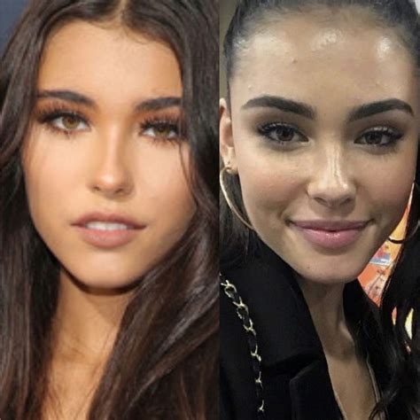 Madison Beer Plastic Surgery Barbie Nose Before And After Cheekbone