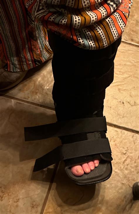 Latest I Broke My Left Foot Just Back From The Emergency Room