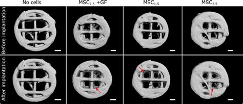 Micro Computed Tomography Of Scaffolds Before And After Implantation Download Scientific
