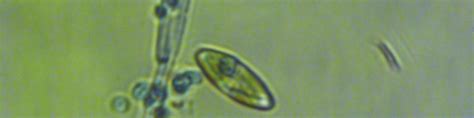 Farah Naaz Phd On Linkedin Prcs2024 Lca Tea Algal Seaweed Biorefinery Saf Prcs2024