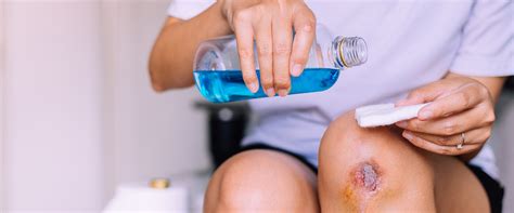 Signs Of An Infected Cut What An Infected Cut Looks Like And How To