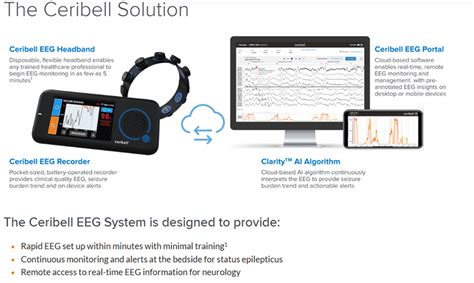 Enhancing Reliability In Real Time Monitoring And Early Prediction Of Epilepsy Using Multimodal
