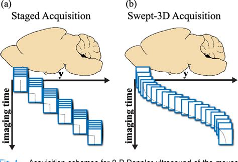 Figure 1 From Swept 3 D Ultrasound Imaging Of The Mouse Brain Using A Continuously Moving 1 D