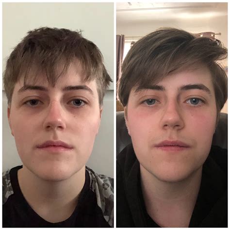 Transgender Before And After Ftm