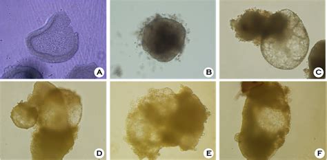 Figure 2 From Differentiation Of Human Embryonic Stem Cells Into Germ