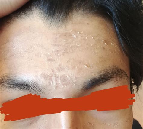 Best R Esthetics Images On Pholder Reality Of Working In A Chain Salon