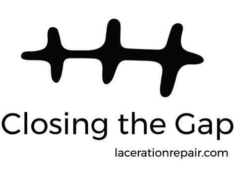 Extensor Tendon Lacerations Part Iii Closing The Gap