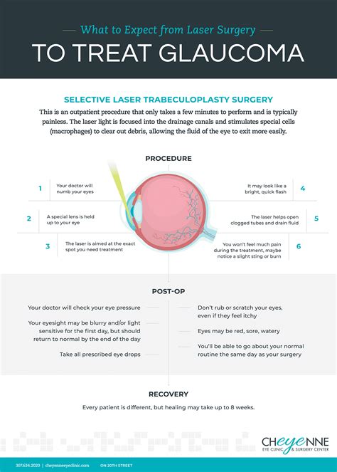 What To Expect From Laser Surgery To Treat Glaucoma
