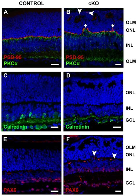 Immunohistochemistry Pictures From P10 Mouse Retinae Retina Sections