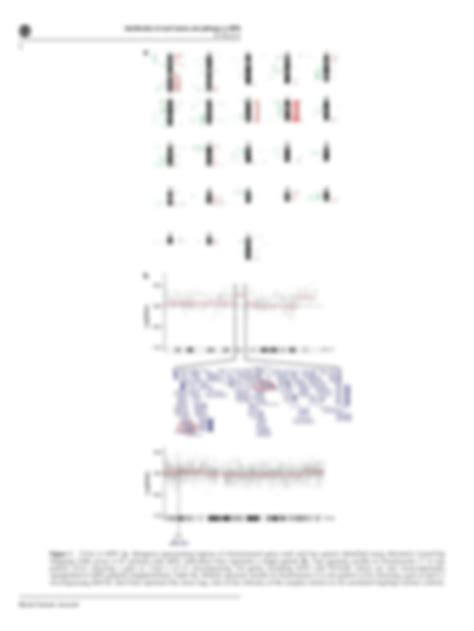 Solution Analysis Of Genomic Aberrations And Gene Expression Profiling Identifies Novel Lesions