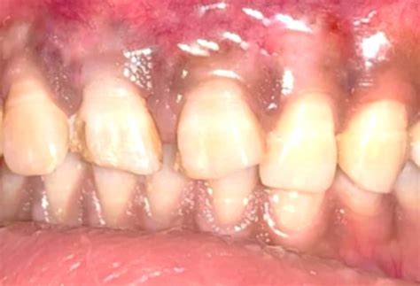 Online Open Access Dental Magazine Journal Publication Dentistry Journal