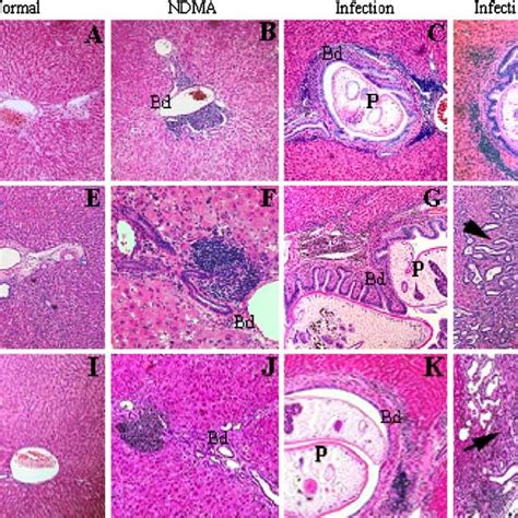 The Expression Levels Of Rb Pathway Genes Rb1 P16 Ink4 Cyclin D1