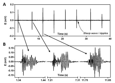 Band Passed Brain Slice Recordings On A 40µm Diameter Microelectrode Download Scientific