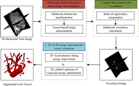 Flowchart Of The Proposed Automatic 3d Us Vessel Segmentation