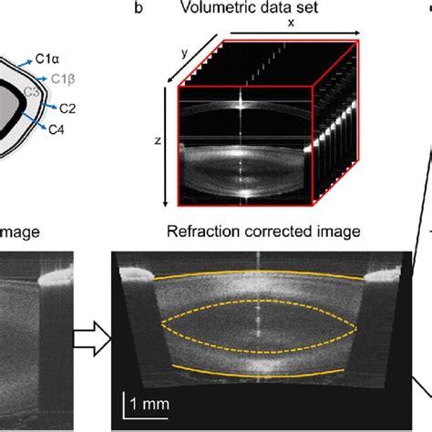 Oct Data Processing A Schematic Diagram Of The Crystalline Lens Left