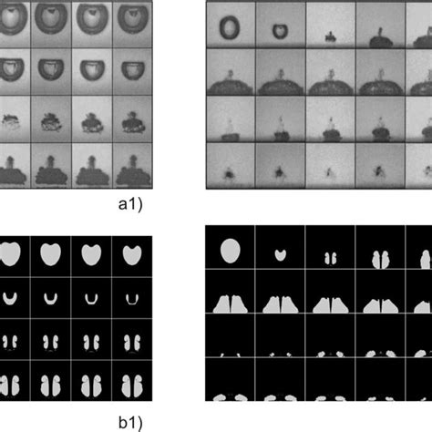 Pdf Numerical Simulation Of A Near Wall Bubble Collapse In An Ultrasonic Field