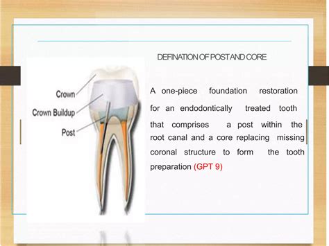 Post And Core PPTX Dental Health Diseases And Conditions