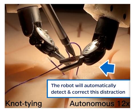 Ai Driven Robot Matches Human Doctors In Surgical Precision