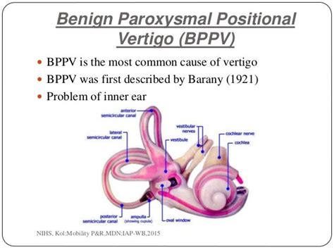 Bppv Physical Diagnosis And Management