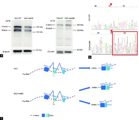 Missense Mutation Cftr P G965d Might Affect Cftr Function By Decreasing Download Scientific