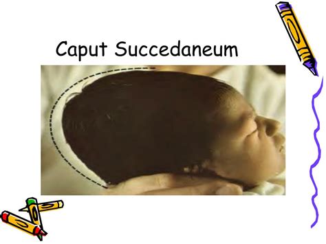 Ppt The Newborn Physical Exam Powerpoint Presentation Free Download