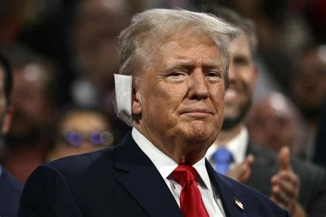 El Médico De Trump Dio Detalles Sobre La Herida Tras El Ataque “la