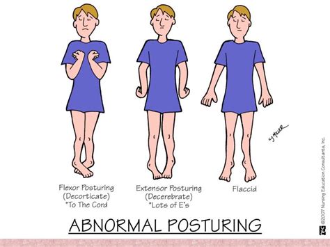 Neurological Assessment For Nursing Students Ppt Ppt