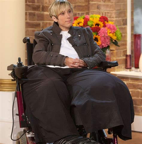Sindrome De Proteus Mandy Selars