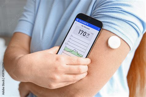 Woman With Glucose Sensor Using Mobile Phone For Measuring Of Blood Sugar Level Closeup Stock Woman With Glucose Sensor Using Mobile Phone For Measuring Of Blood Sugar Level Closeup Stock