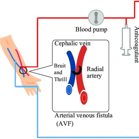 Frequency Spectrum Of AVF Pulse Wave Waveform Download Scientific Diagram