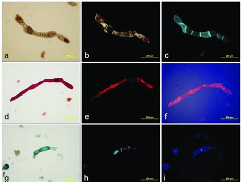 Te Like Cells Or Longitudinal Parenchyma Cells Formed In Suspension