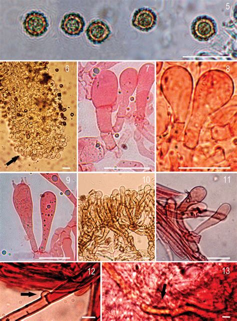 Basidiomycota Microscope