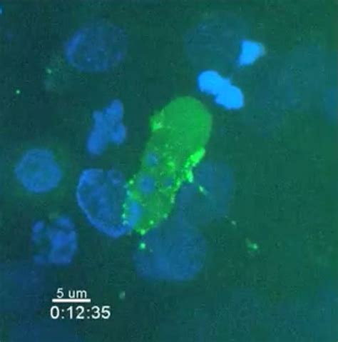 Video Reveals How Hiv Infects Healthy Cells During Sex And How To Protect Yourself The Irish Sun